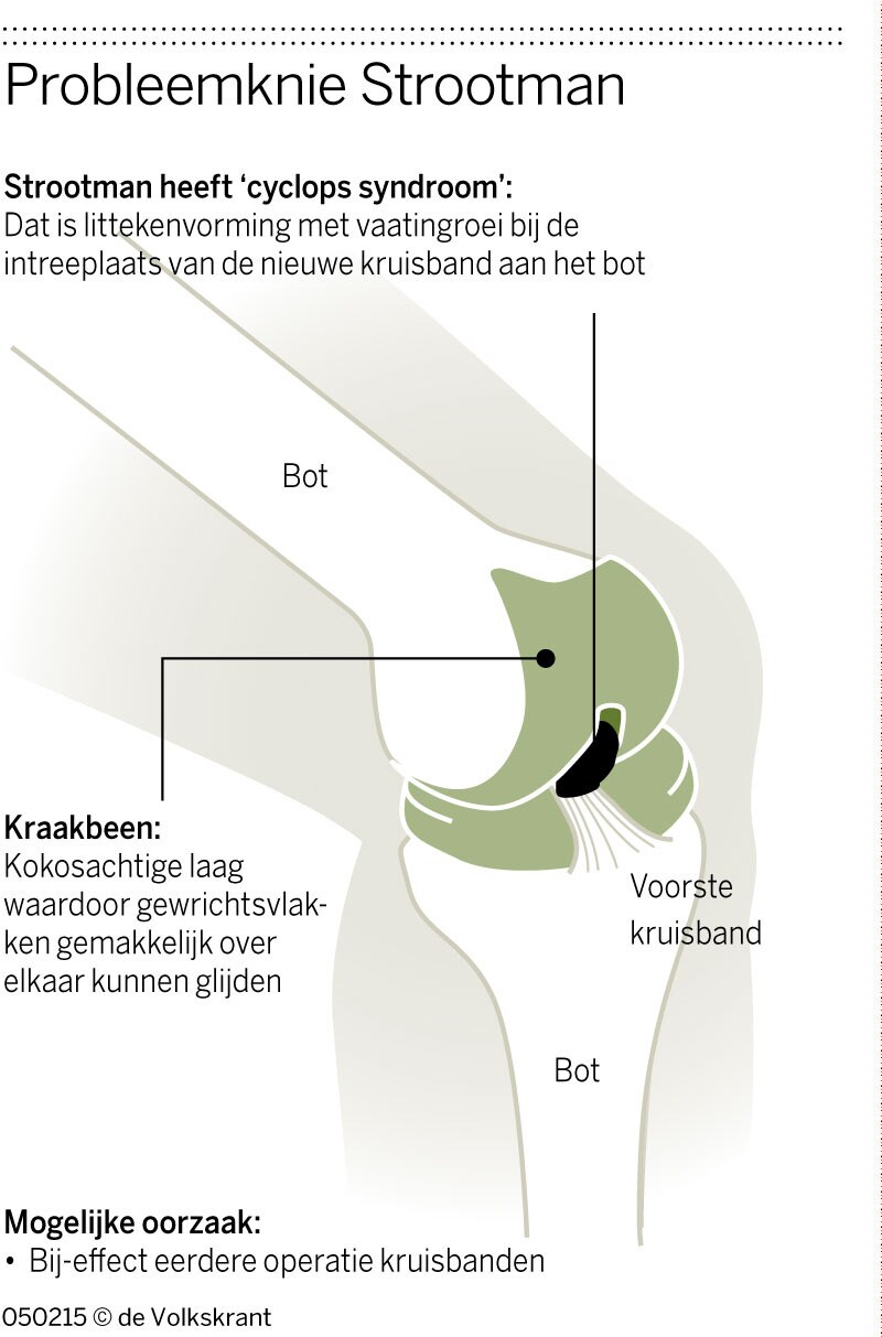 Schade aan kraakbeen is angstdroom voor iedere voetballer | de Volkskrant