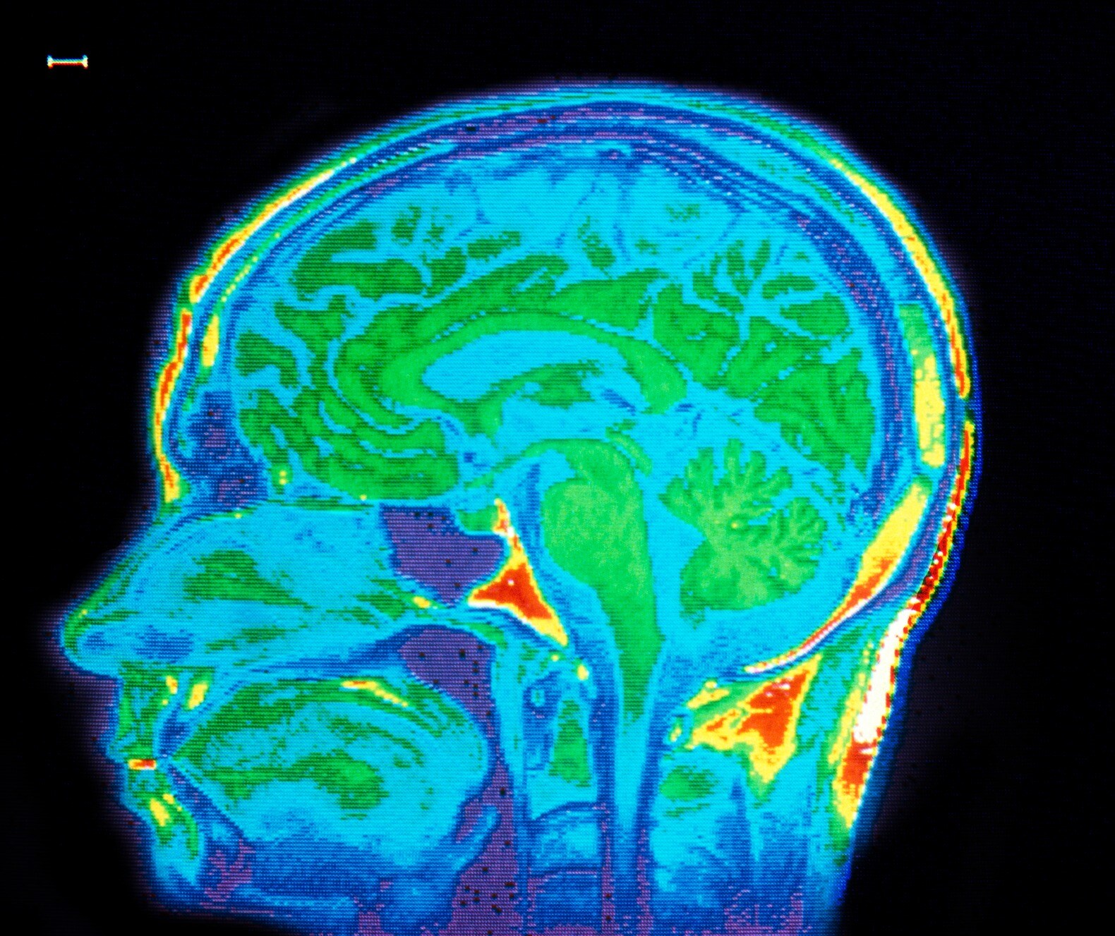 'Sorry, edelachtbare, mijn frontaalkwab is een gatenkaas' | de Volkskrant
