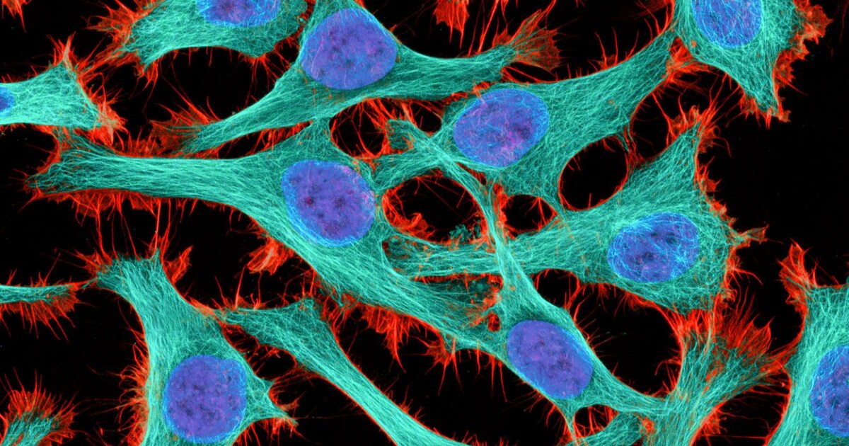 Voor dit onderzoek zijn de verkeerde cellen gebruikt | de Volkskrant