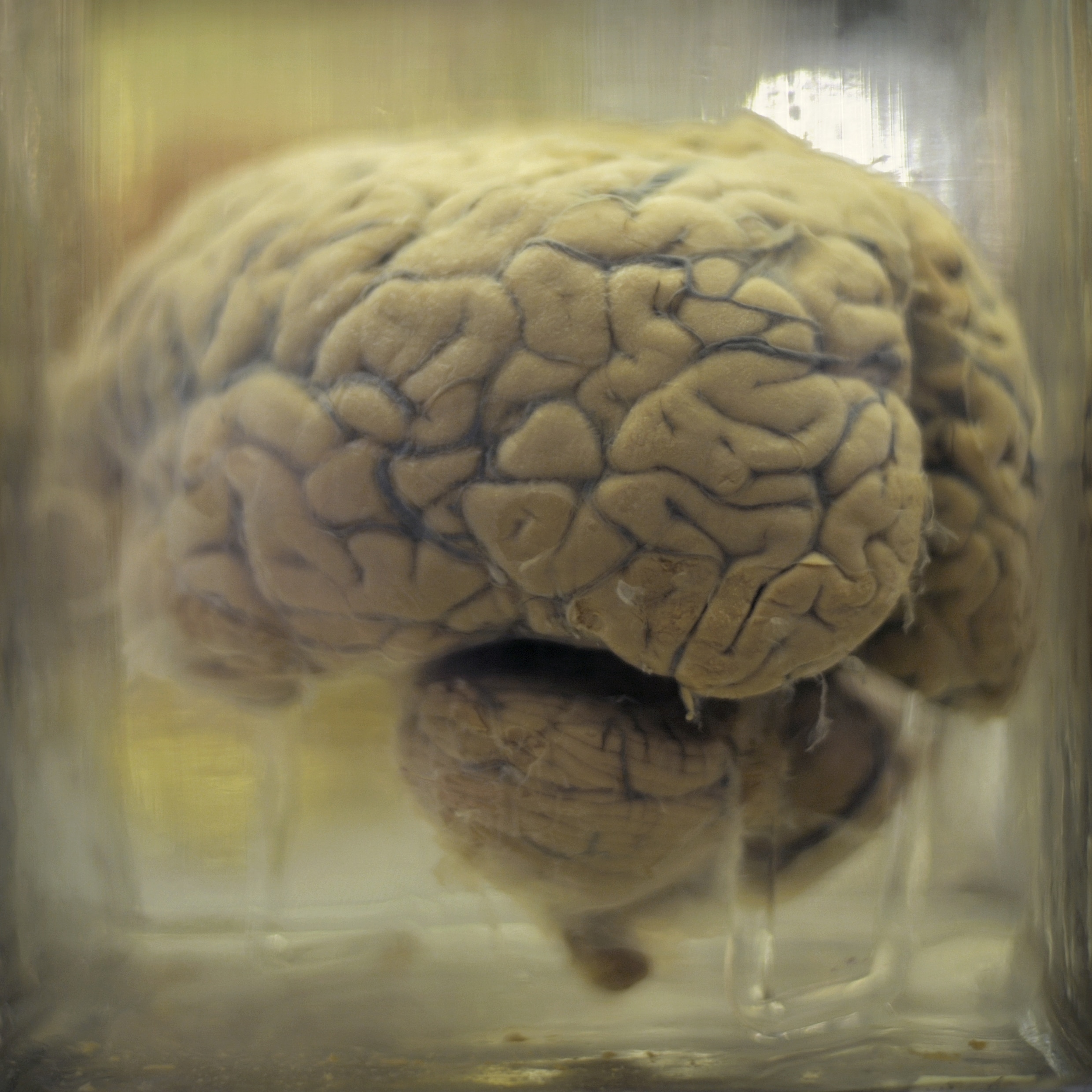 Grote hoeveelheid microplastics aangetroffen in menselijke hersenen ...