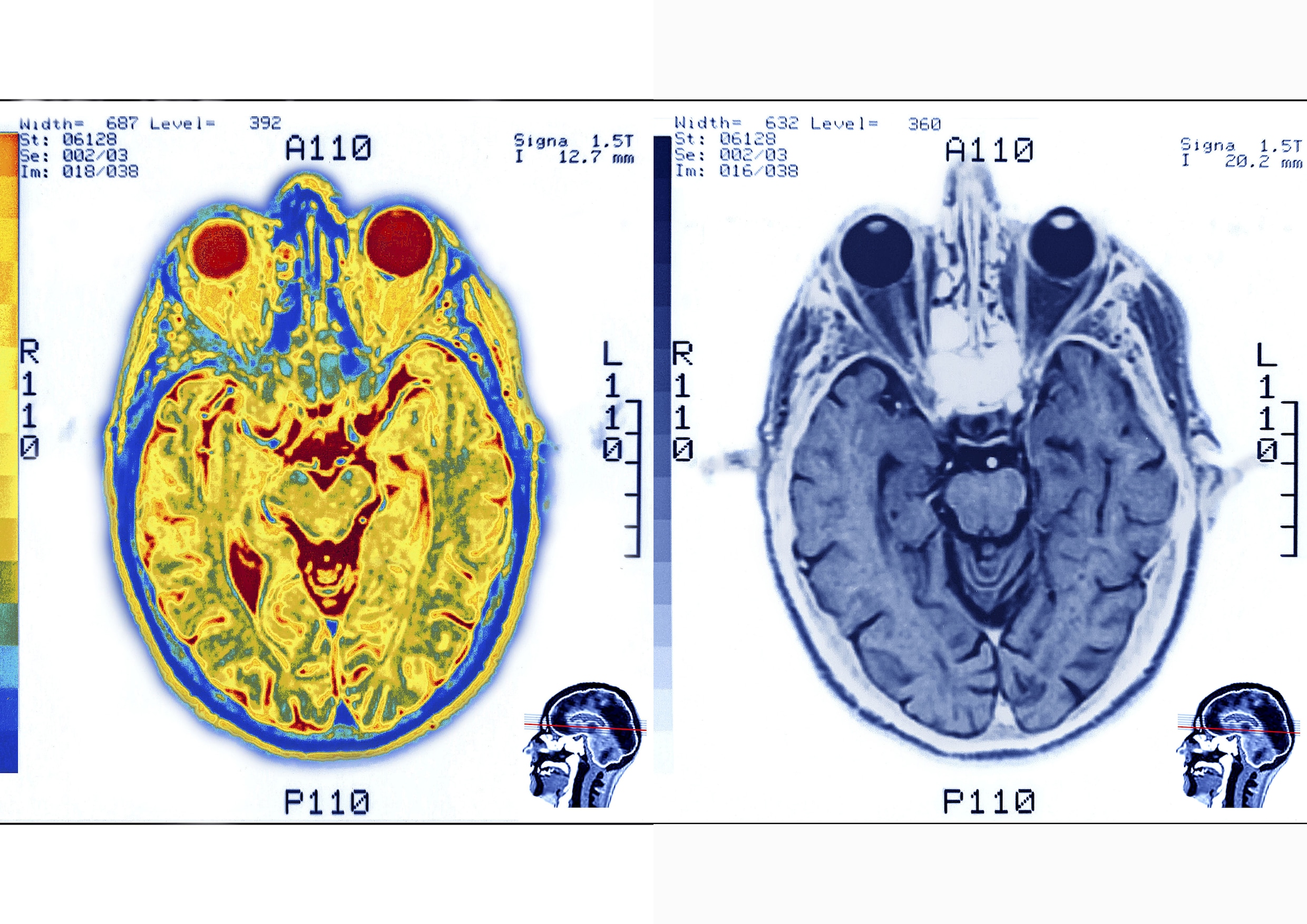 Promotie-onderzoek: onze hersenen zijn een toekomstvoorspeller | de ...