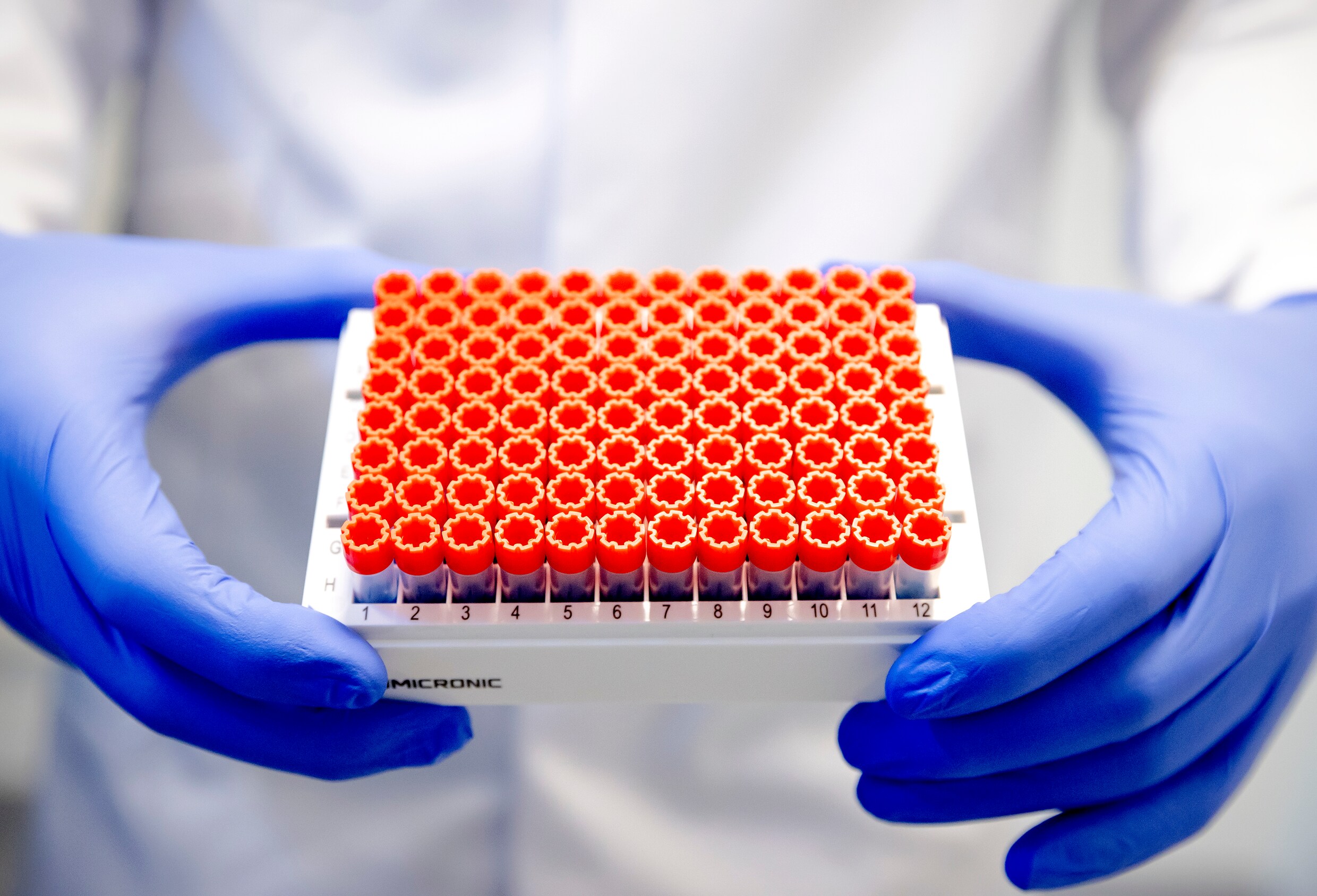 Labstrijd loopt hoog op: ministerie komt ‘The Beast’ weghalen | de ...