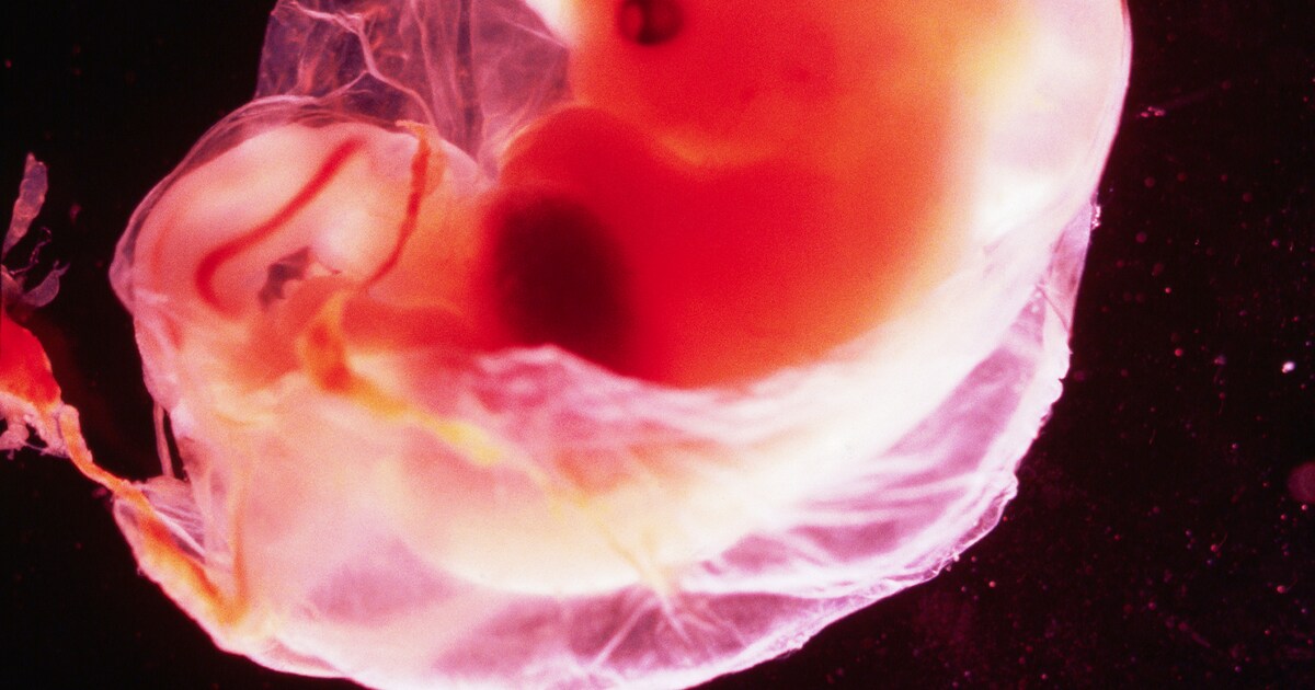 Gezondheidsraad: verruim mogelijkheid onderzoek embryo’s naar een maand ...