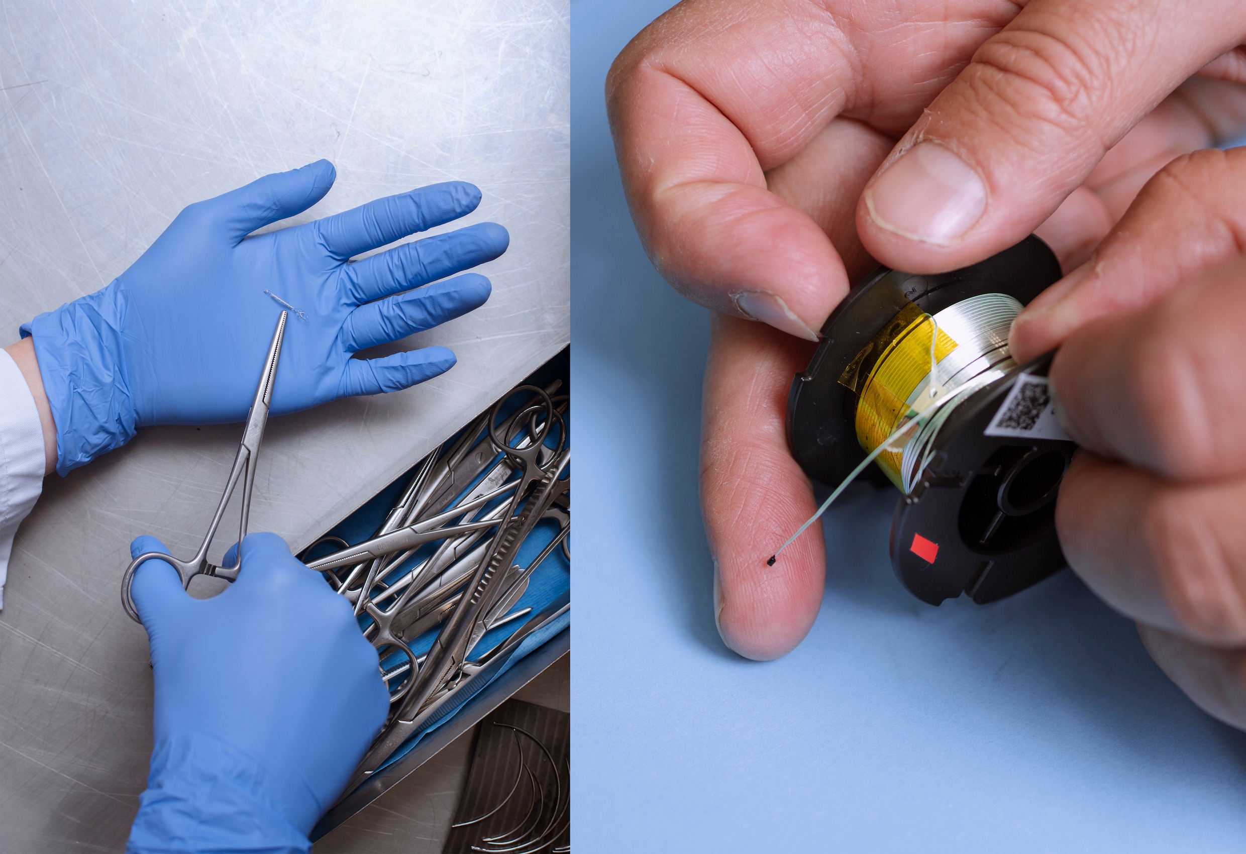 Revolutionaire nieuwe vorm van anticonceptie: sluis in eileiders die ...